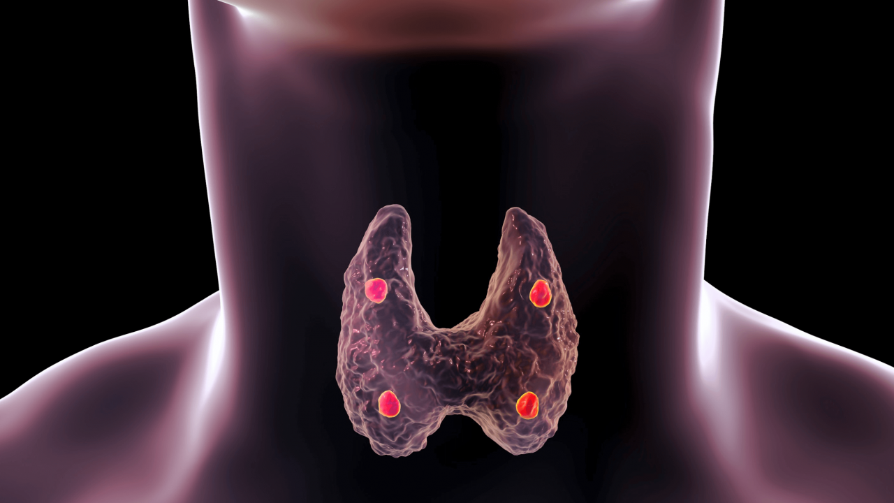 How Long Is Recovery Time After a Thyroidectomy? - Arizona Premier Surgery