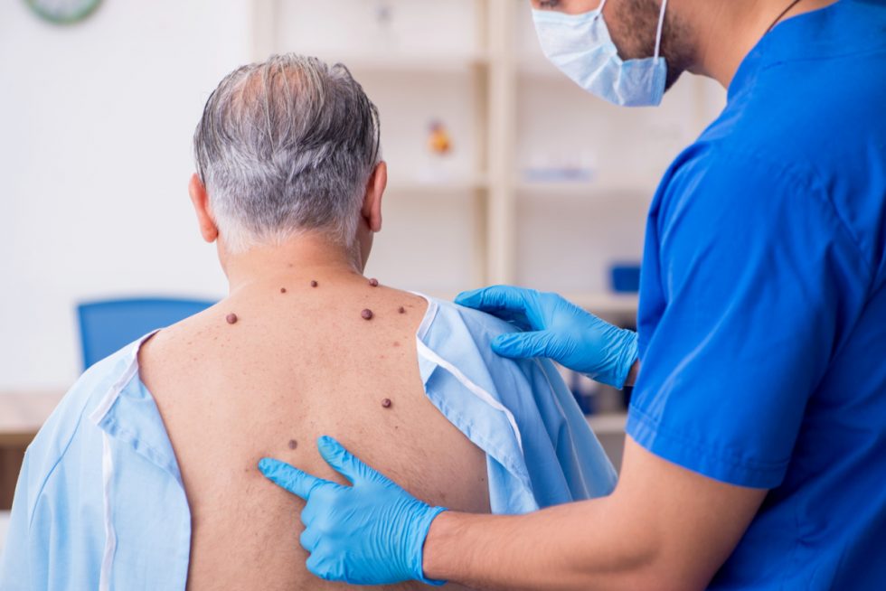 Skin Lesion Removal: What To Expect As a Patient - Arizona Premier Surgery